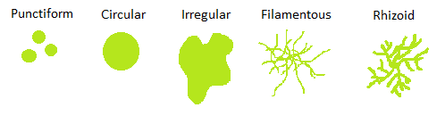 Bacterial Colony: Morphology, Characteristics & Definition - Video ...