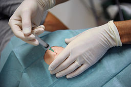 Blaise Pascal Syringe