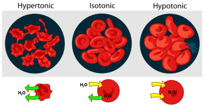 Hypertonic Solution: Definition, Effect & Example | Study.com