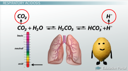 respiratory - acidosis _121828.png